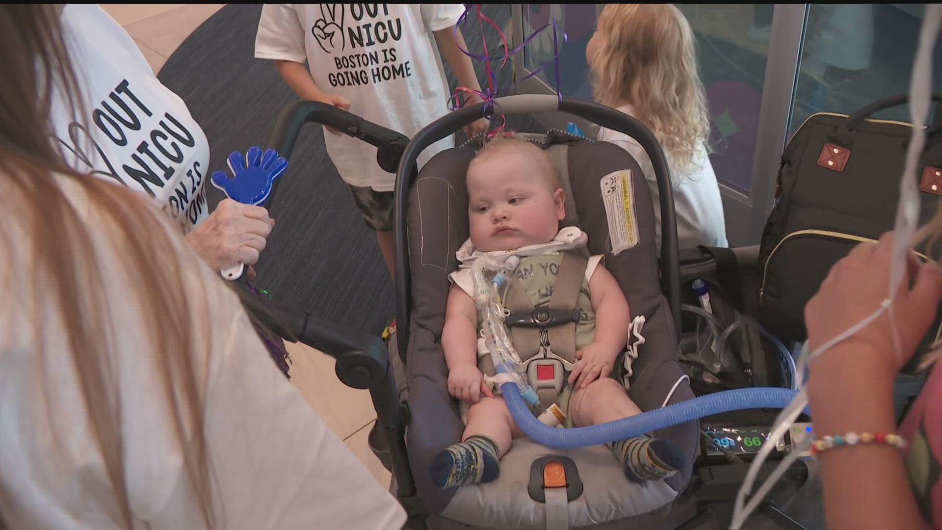 Over a year after he was born, baby with rare birth defect goes home ...