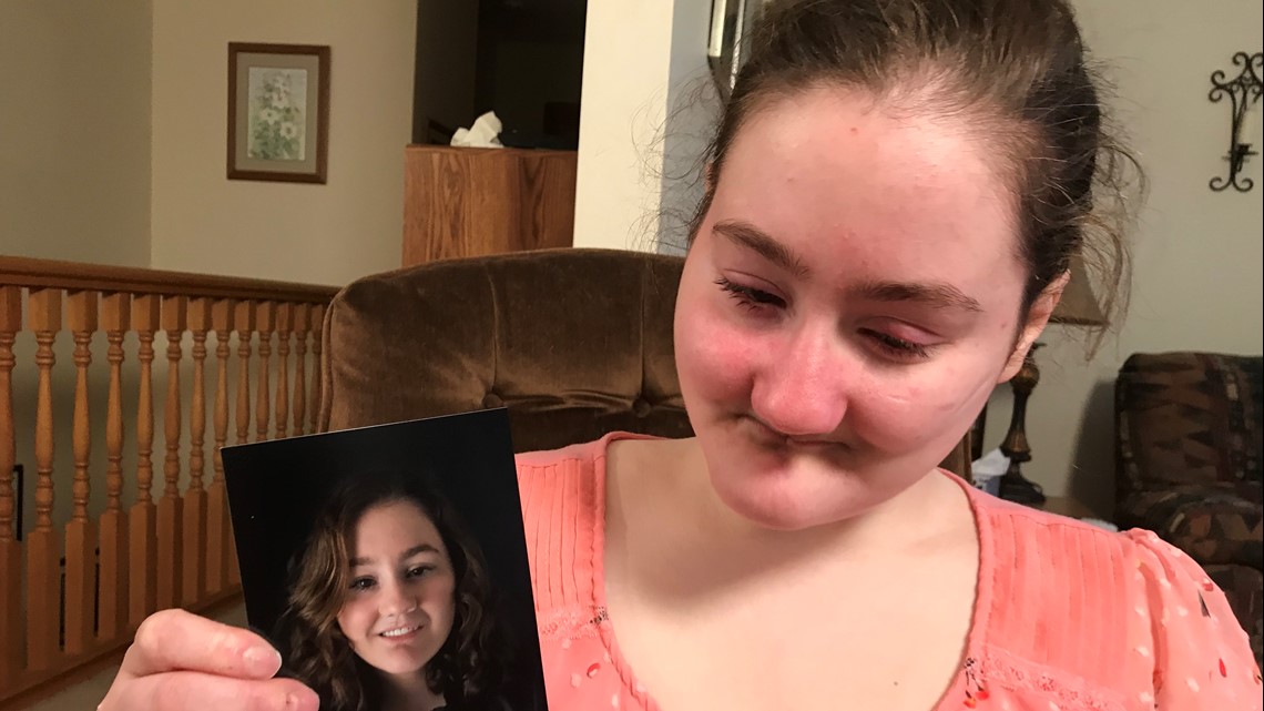 Fundraisers started to help Gabby smile | kare11.com