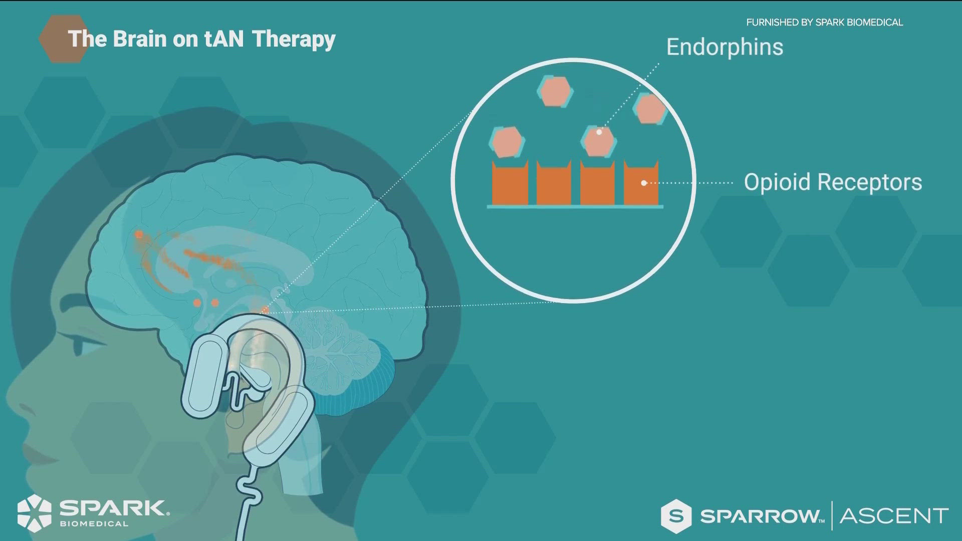 FDA-approved device aids opioid detox in young adults | kare11.com
