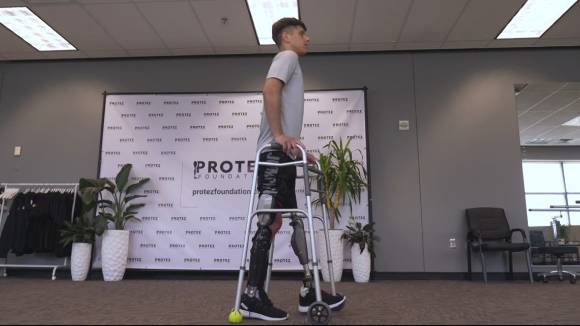 Ukrainian teen fitted with prosthetic | kare11.com