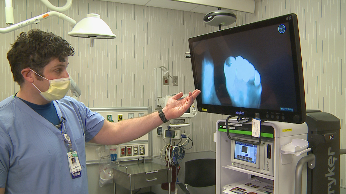 Doctors at HCMC use new imaging technology to treat frostbite cases ...