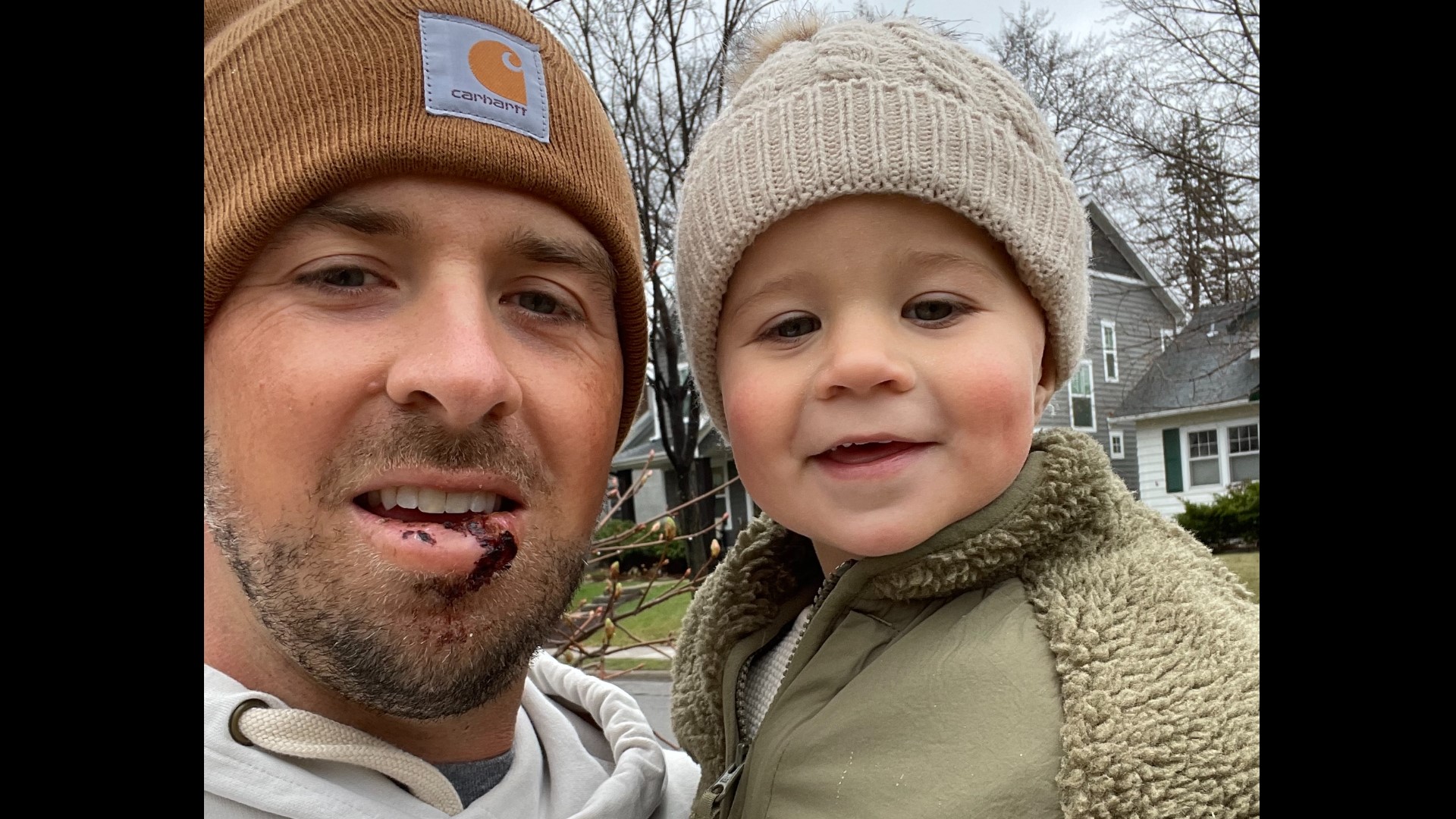 Twins infielder Kyle Farmer recounts 92 mph beanball | kare11.com