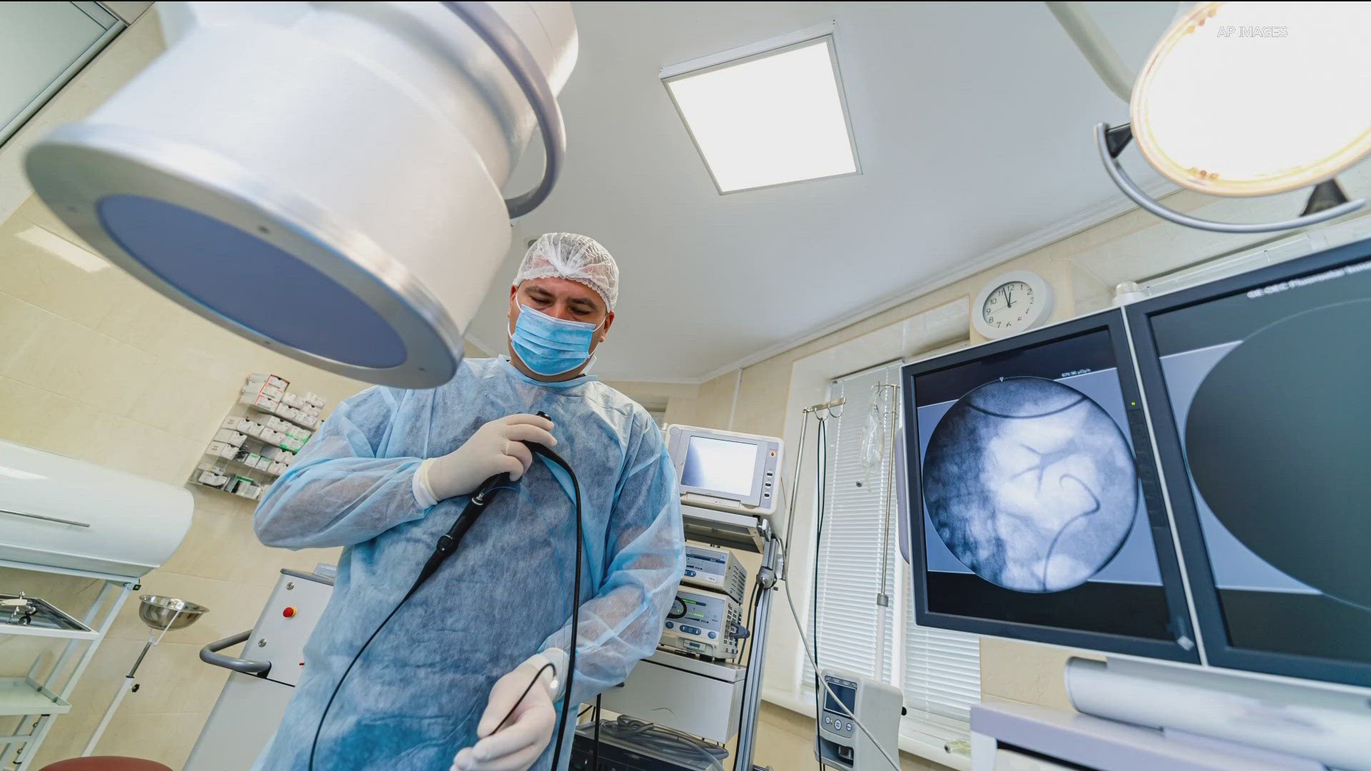 4 most common signs of colorectal cancer | kare11.com