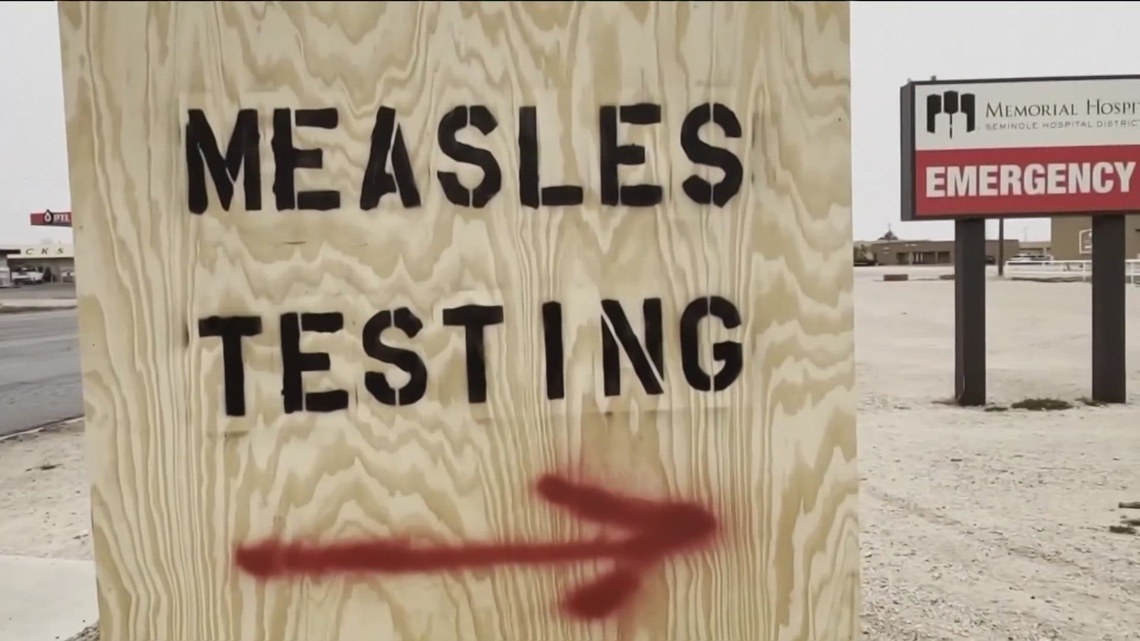 Knowing the warning signs of measles | kare11.com