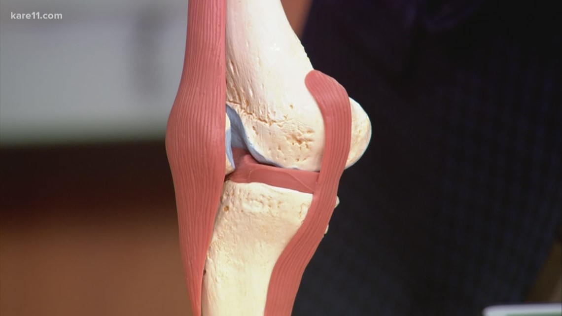 Creaky joints? When to seek help | kare11.com