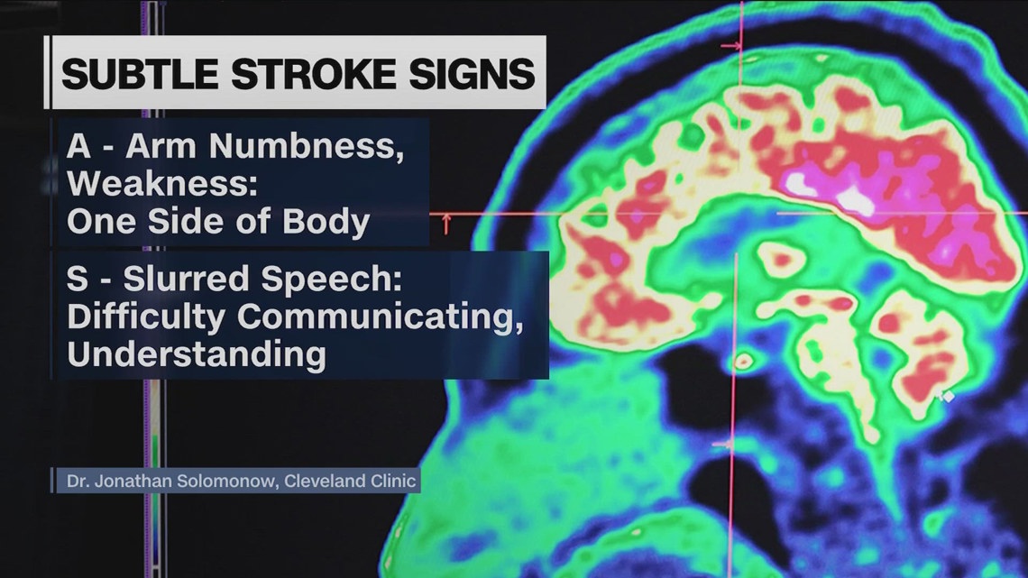 Stroke care access expands for more Minnesotans | kare11.com