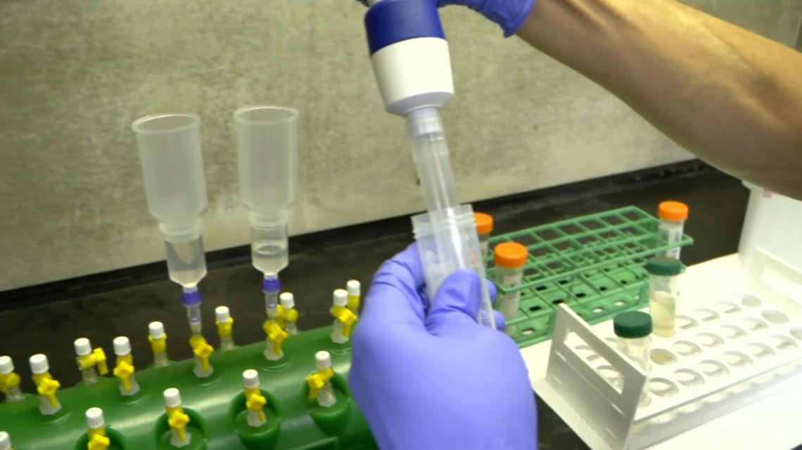 Wastewater is helping detect measles cases, and it comes at a critical ...