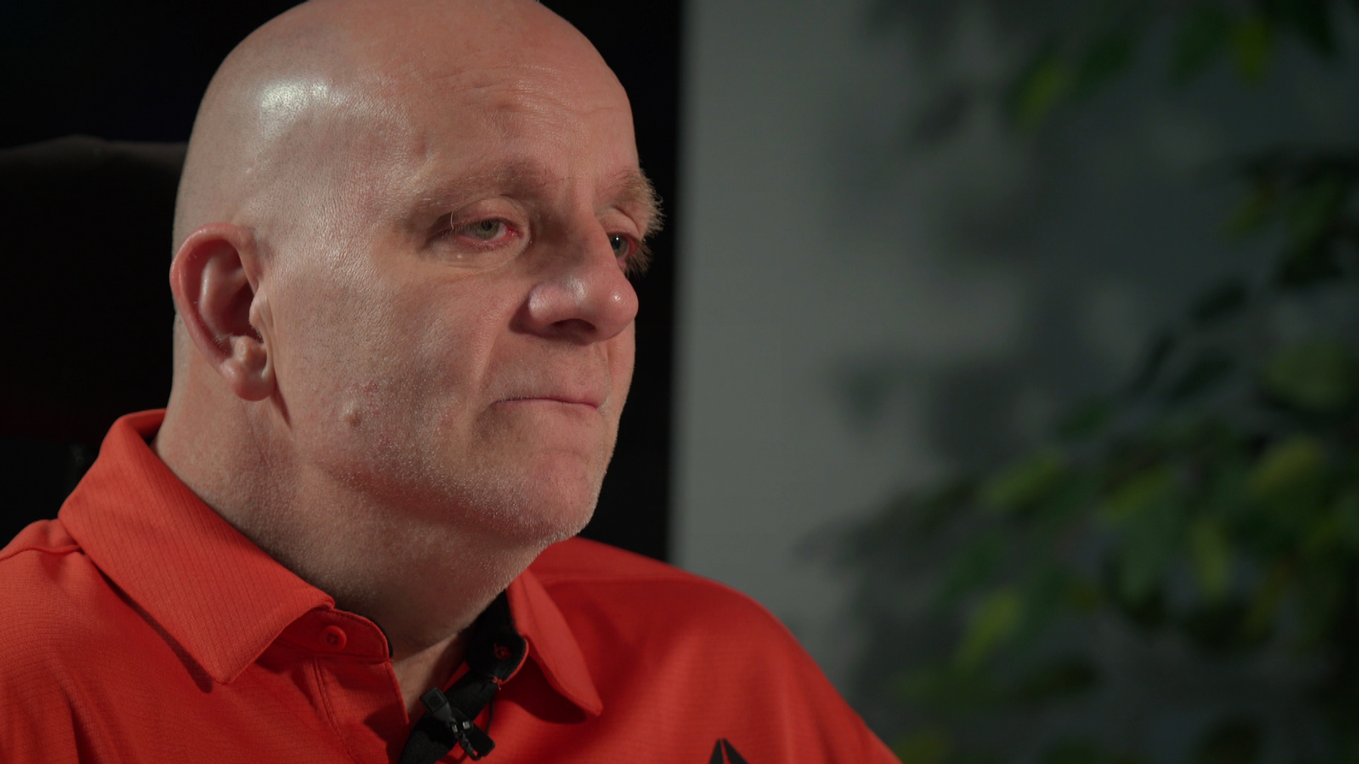 KARE 11 Investigates: Patients paralyzed after spinal implant for pain ...