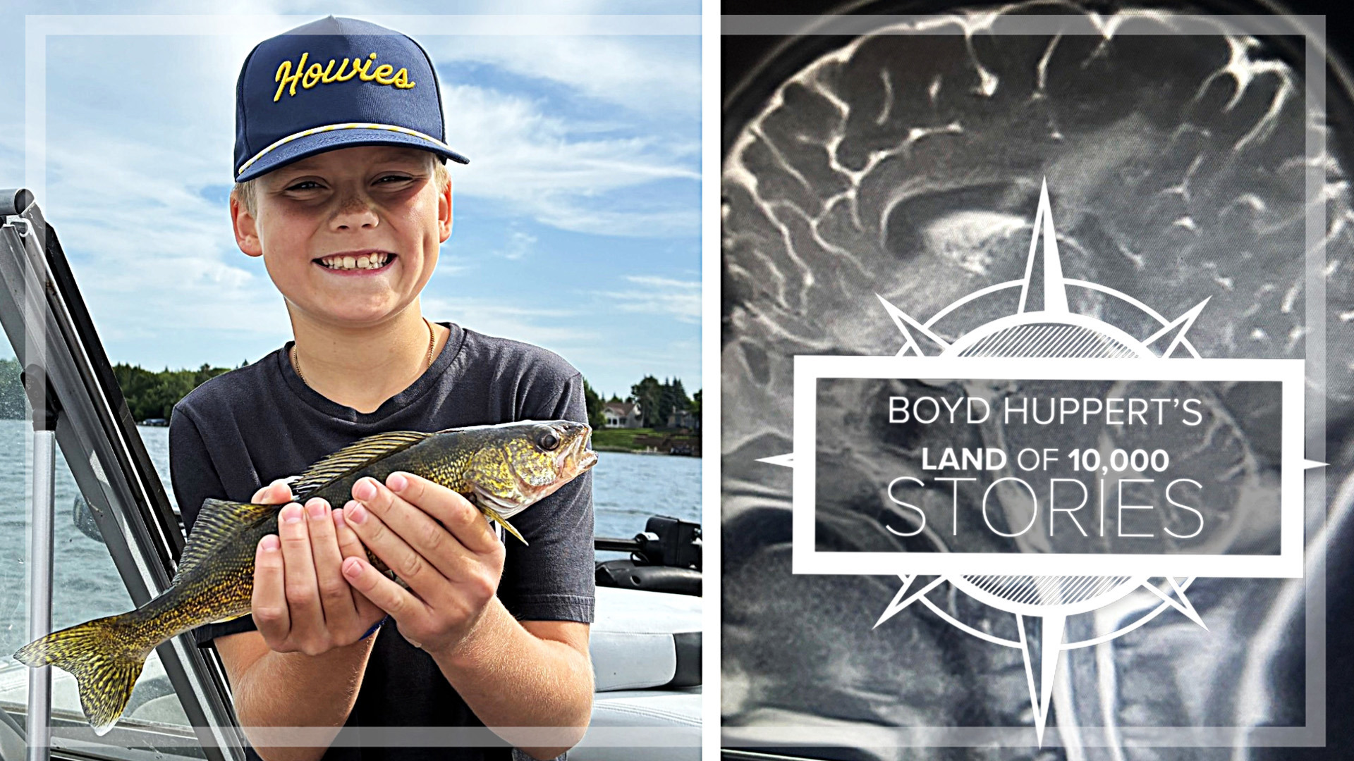 9-year-old MN boy survives arrow through his brain | kare11.com