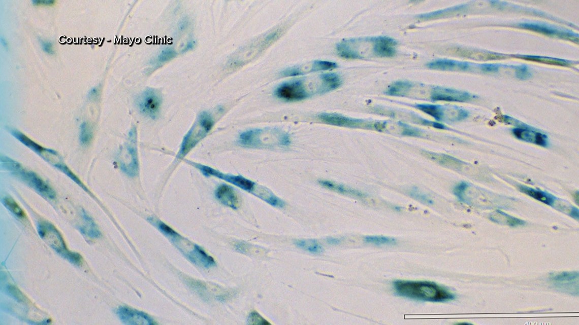 Mayo Clinic researchers find cells that could be the culprits of ...
