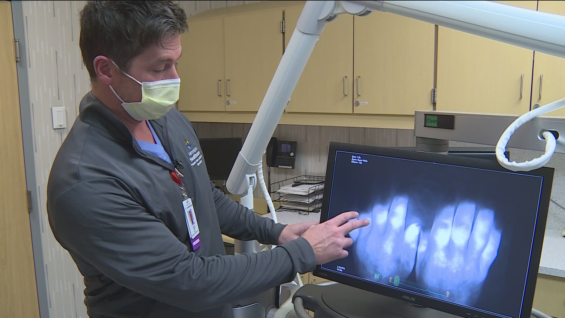 Local doctors prepare to see uptick in cases of frostbite during cold ...