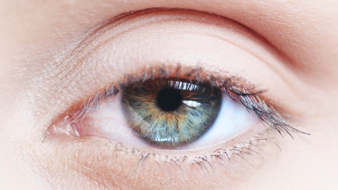 Nebraska woman finds parasitic eye worms after encountering flies ...