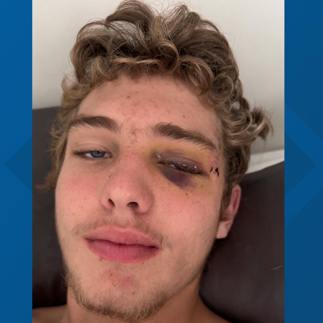Deshler student's family seeks answers after injury | kare11.com