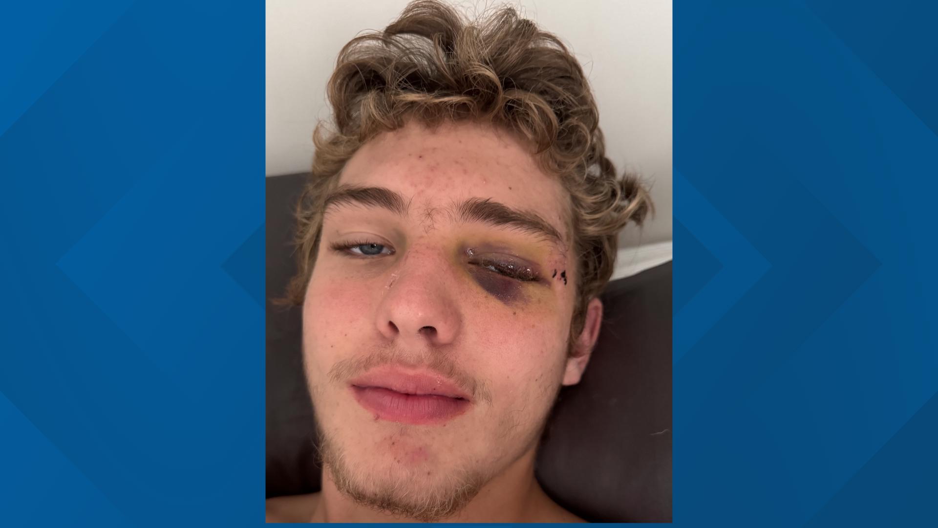 Deshler student's family seeks answers after injury | kare11.com